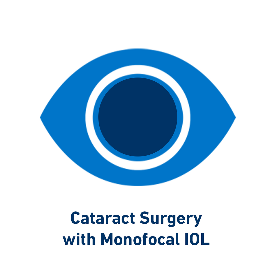 Cataract Surgery with Monofocal IOL – CODET Vision Institute